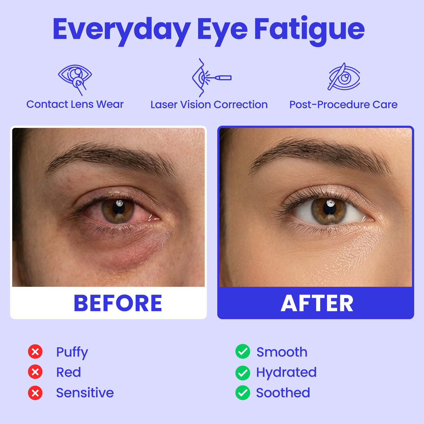 Eye Serenity Steam Eye Mask for Dry Eyes, Puffiness, Travel Relaxation ...